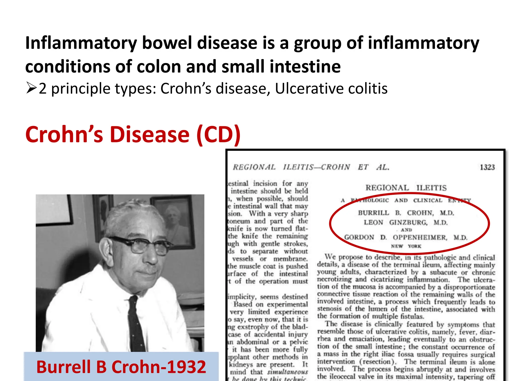 CROHNS DISEASE.pptx by Dr. Chayanika Das | PPTX