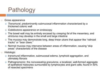 Crohn’s disease | PPTX