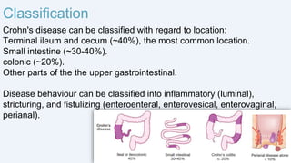 crohns disease 1.pptx