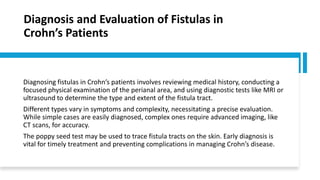 Crohn’s Disease and Fistula Care Tips.pdf