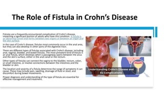 Crohn’s Disease and Fistula Care Tips.pdf
