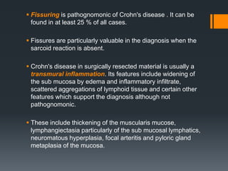 Crohn’s disease histopathology | PPTX | Digestive Disorders | Diseases ...
