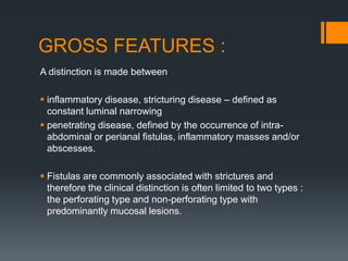 Crohn’s disease histopathology | PPTX
