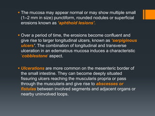 Crohn’s disease histopathology | PPTX