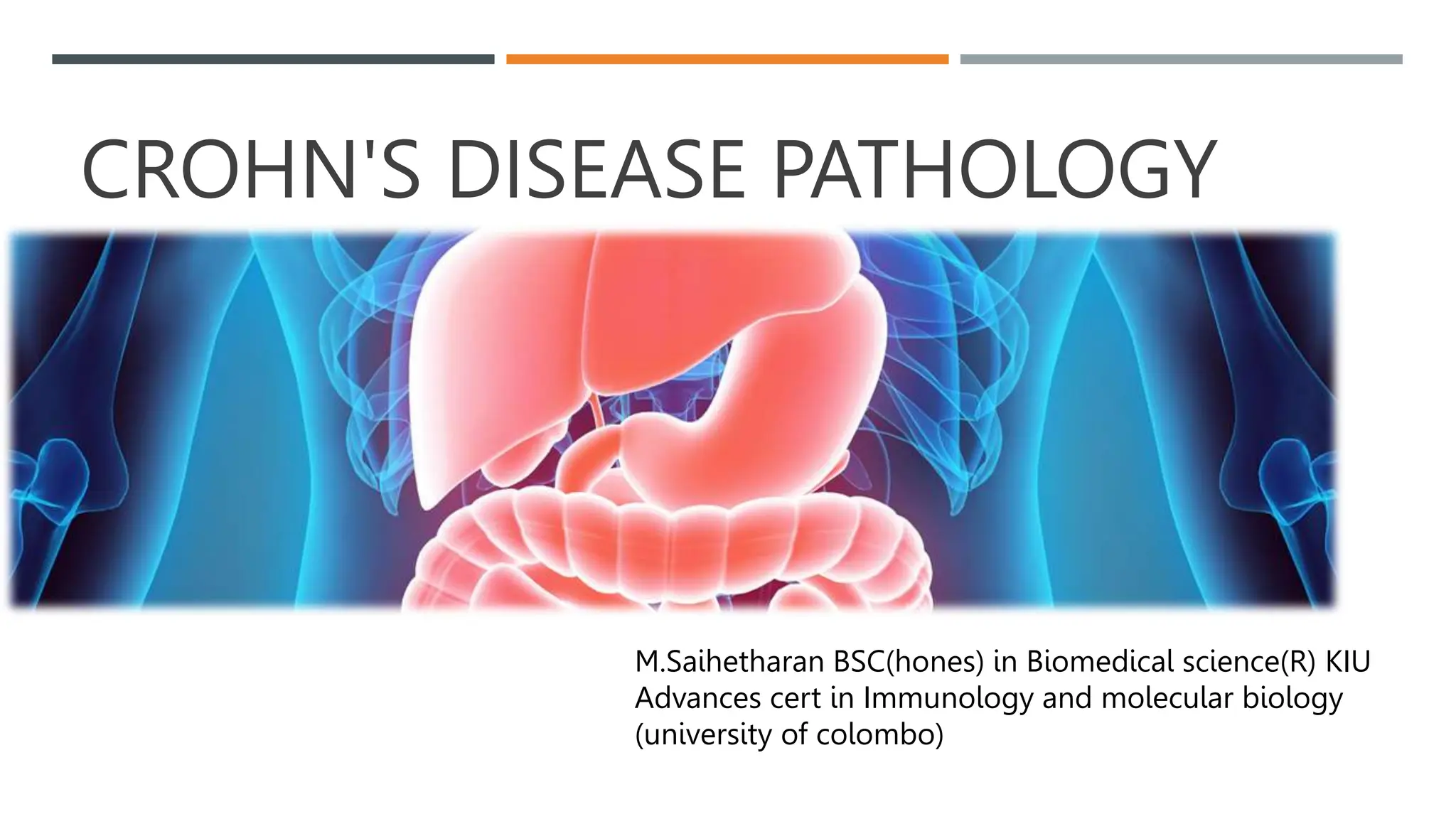 Crohns Disease Pathology Prsentation Unfinshedpptx