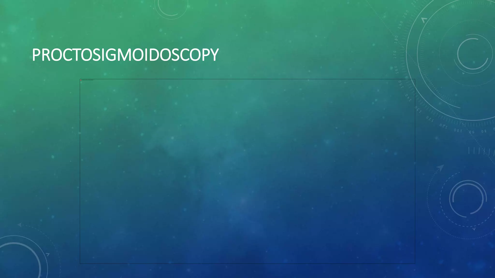 Crohns disease presentation | PPTX