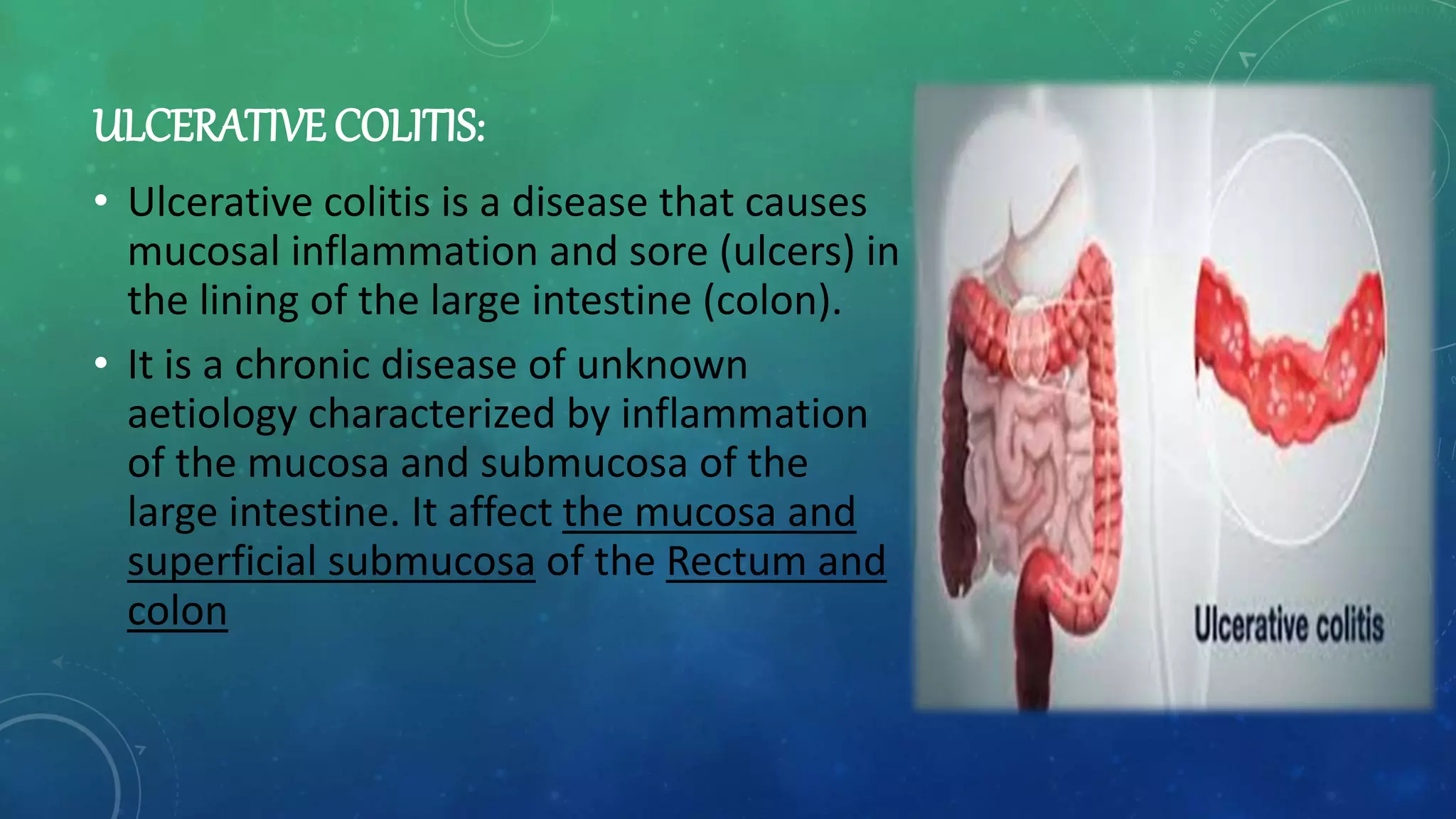 Crohns disease presentation | PPTX