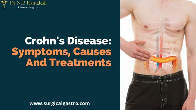 Crohns Disease Symptoms Causes And Treatments