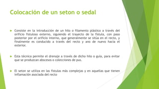 Enfermedad Inflamatoria Intestinal - Crohn y cuci- | PPTX