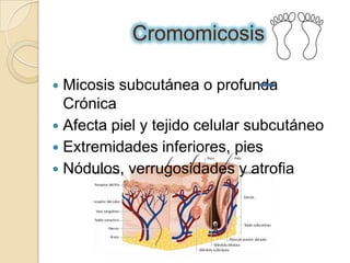 Cromoblastomicosis | PPTX