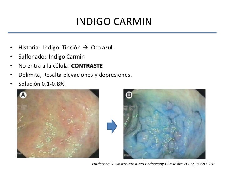 INNSZ. Cromoendoscopia