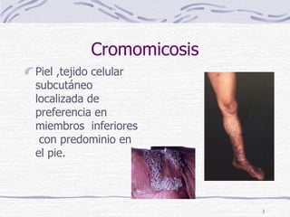 Cromomicosis | PPT