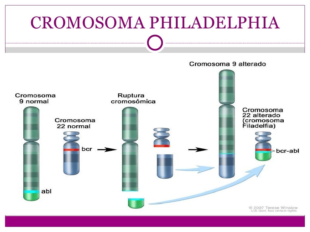 Cromosoma Philadelphia