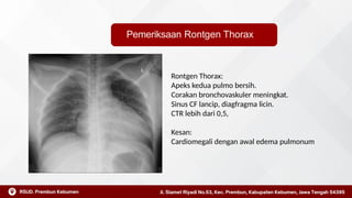 Laporan Kasus Cronic Kidney Disease (CKD) | PPTX