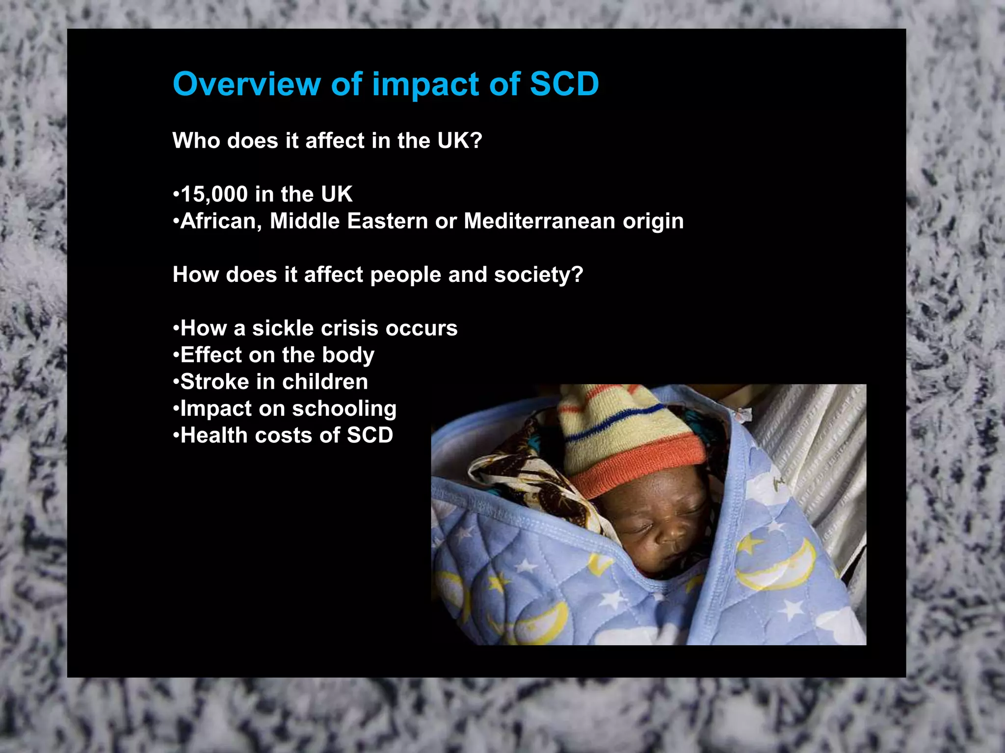 "Heat as Medicine" - The Keeping Warm With Sickle Cell Disease Project ...