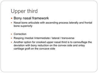 Crooked nose2023.pptx