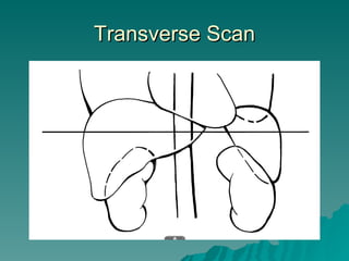 Cross Sectional Anatomy Of The Abdomen Annotated | PPT