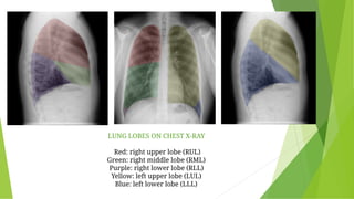 IMAGINFG OF CROSS-SECTIONAL ANATOMY OF LUNG.pdf
