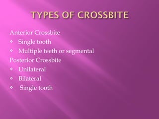 Malocclusion-Cross bite | PPT