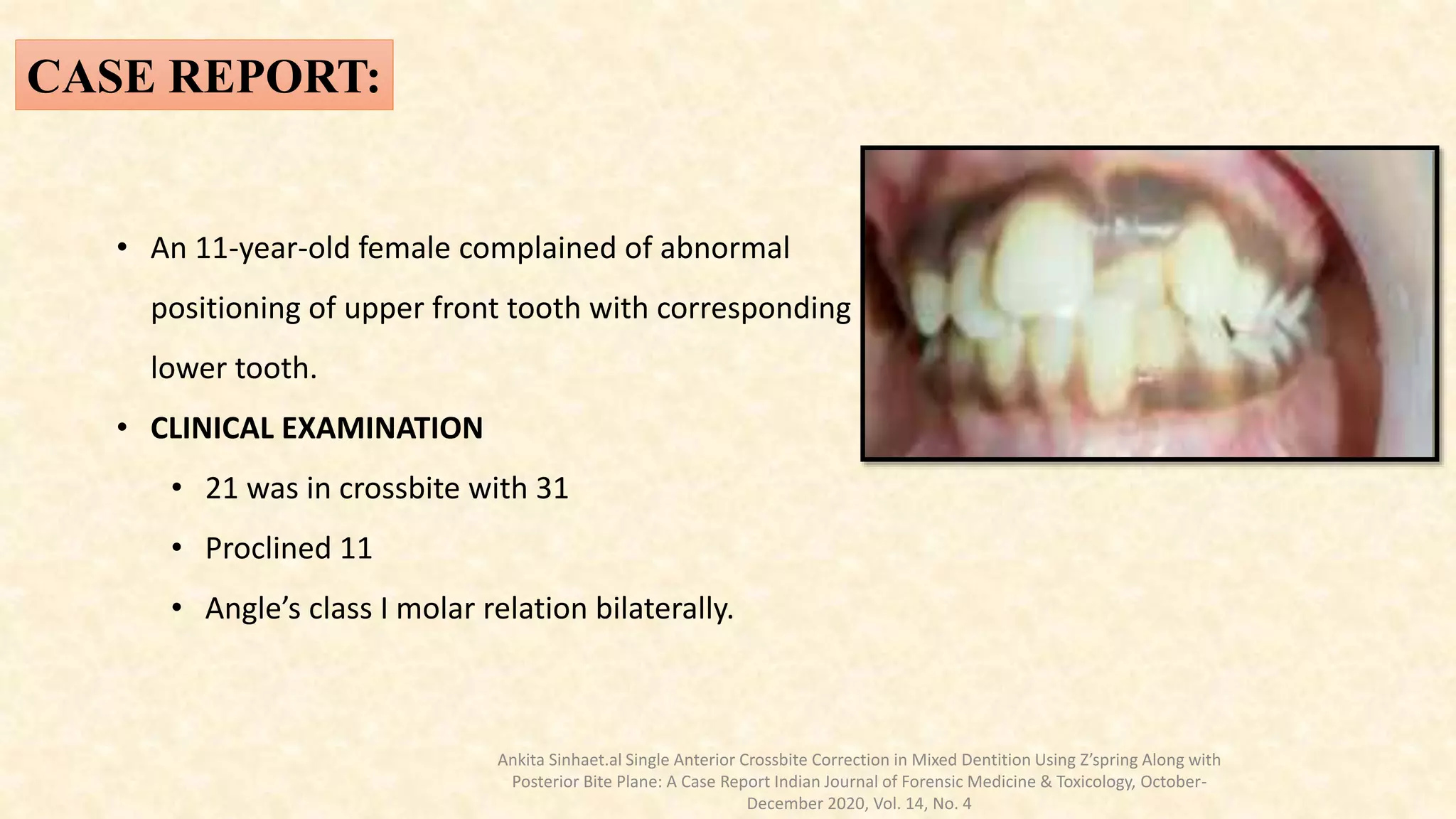 crossbite.pptx