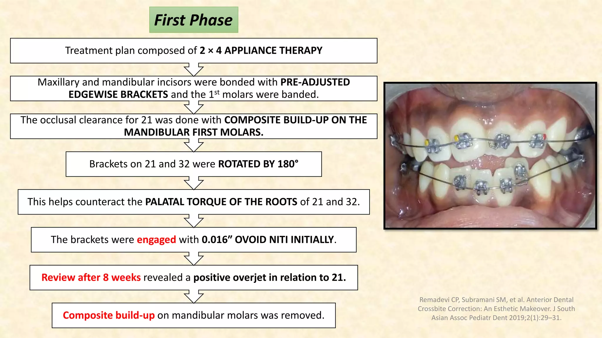 crossbite.pptx