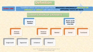 crossbite.pptx