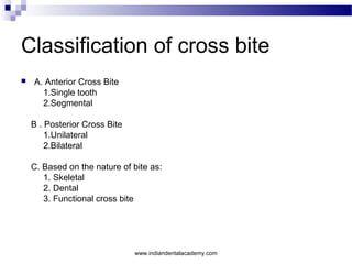 Cross bite 2 | PPT