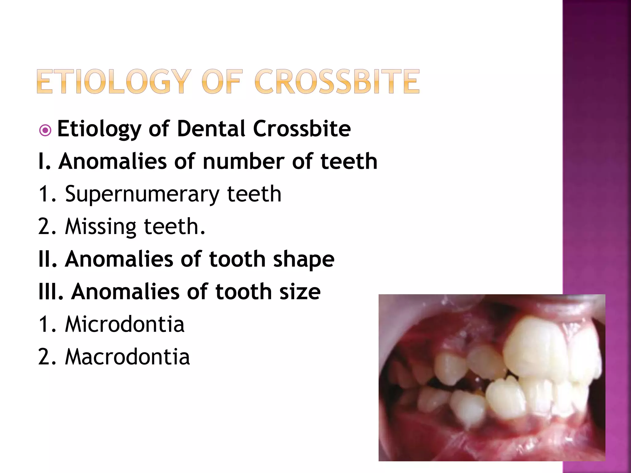 Cross bite and it's management venkat | PPTX