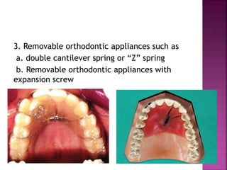 Cross bite and it's management venkat | PPTX