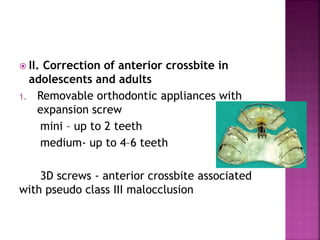 Cross bite and it's management venkat | PPTX