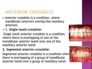 Cross bite and it's management venkat | PPTX