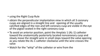 Crossing aortic valve | PPT