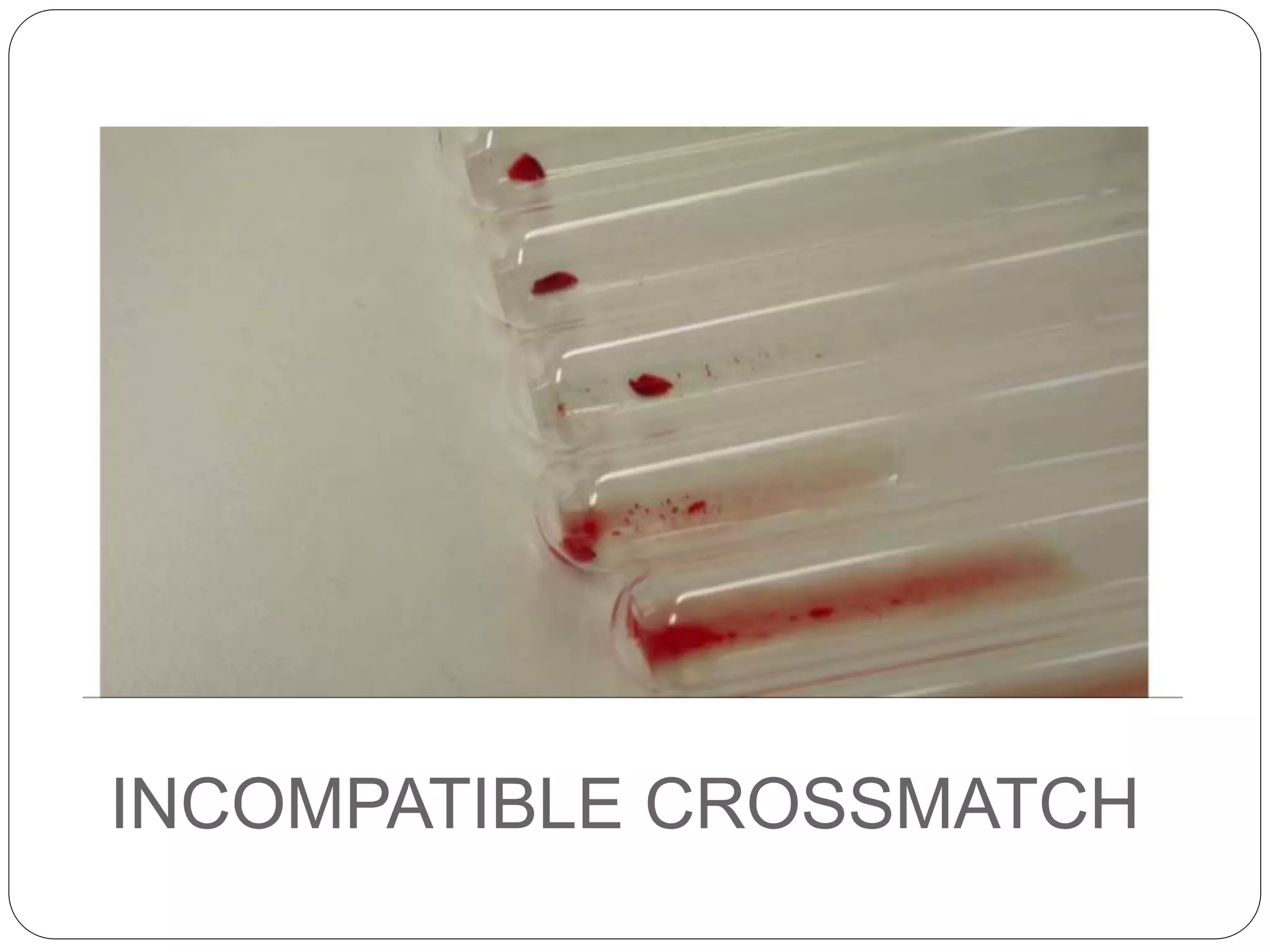 Crossmatching | PPTX