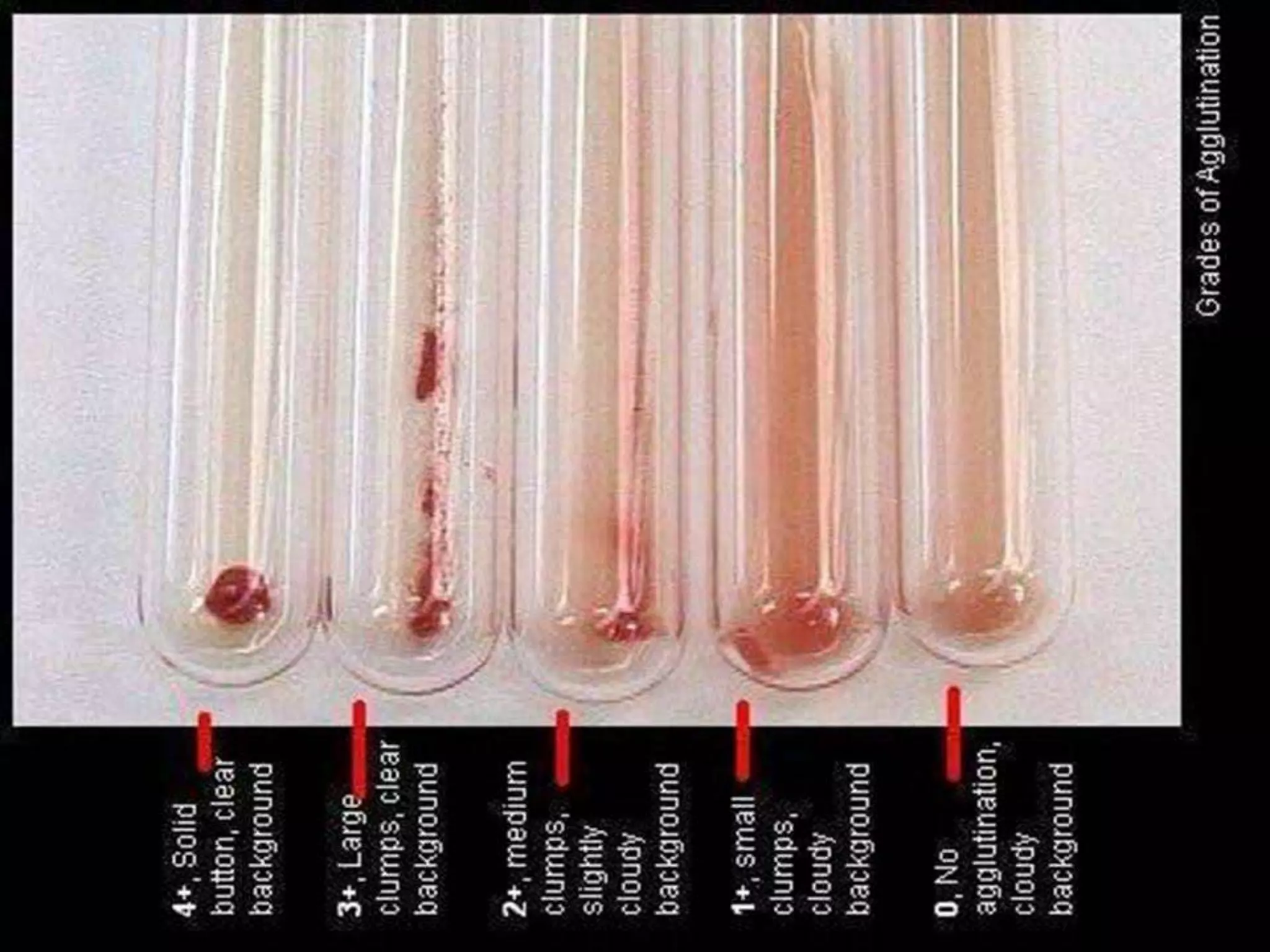 Crossmatching | PPTX