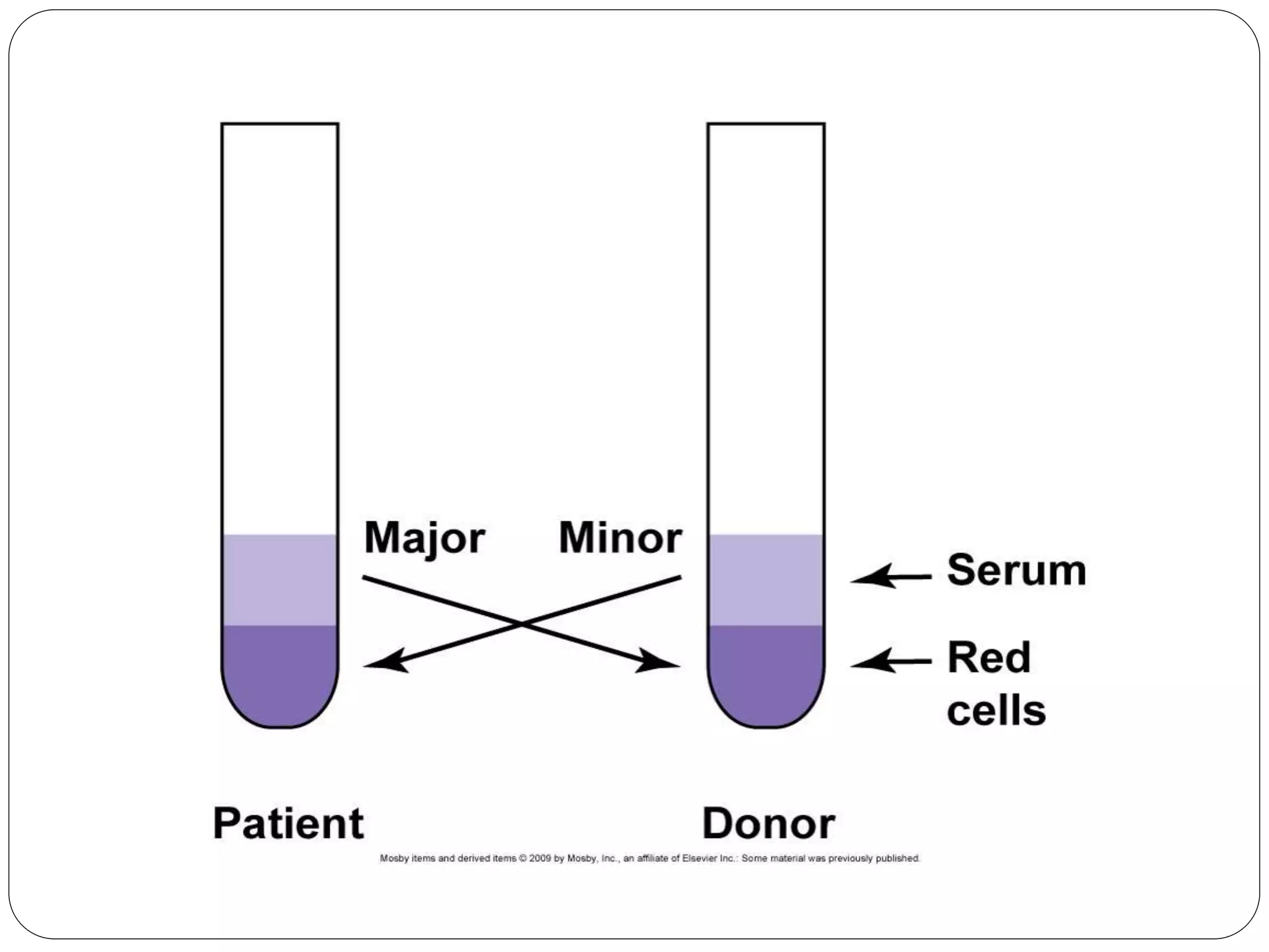 Crossmatching | PPTX