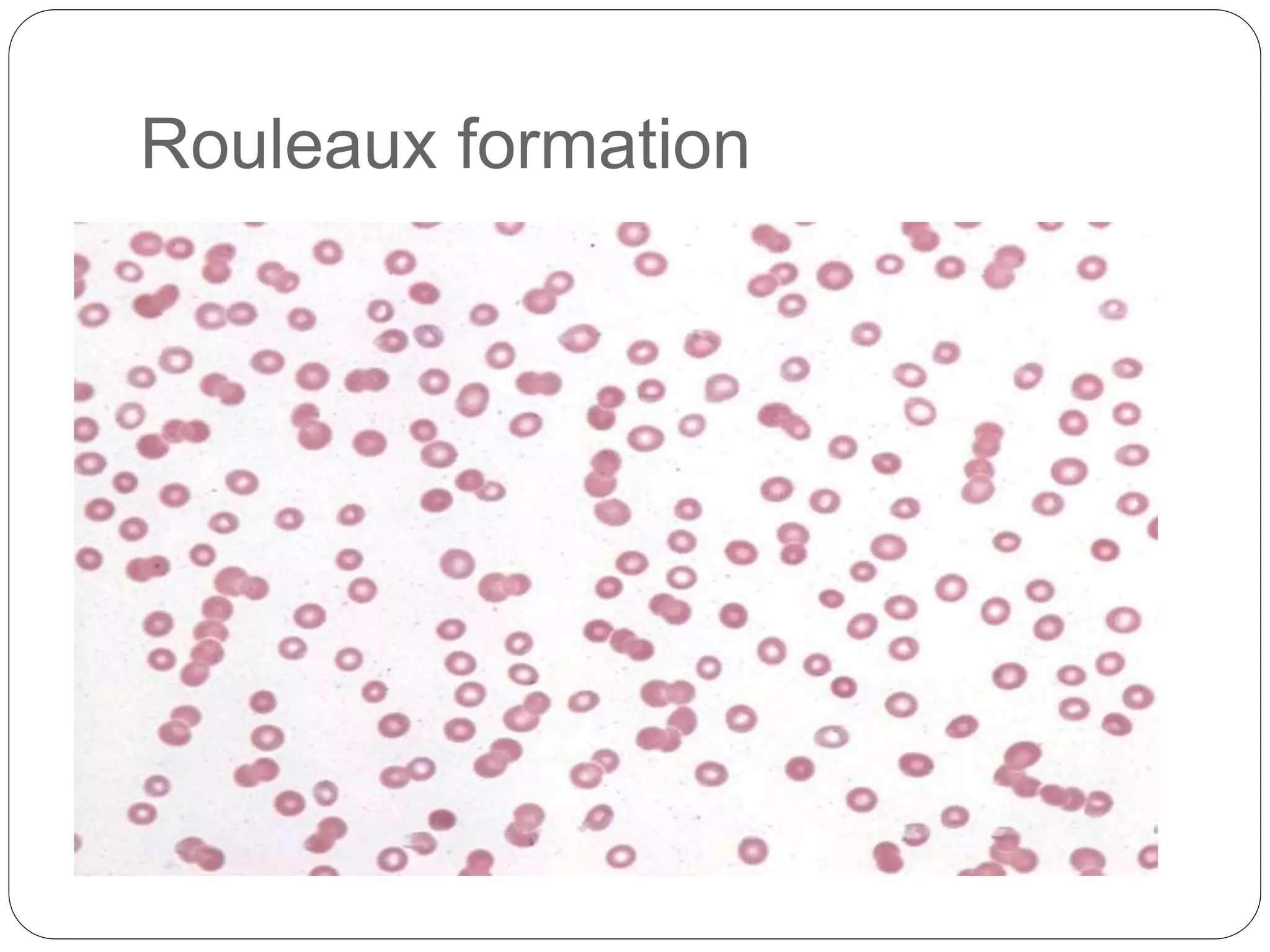 Crossmatching | PPTX