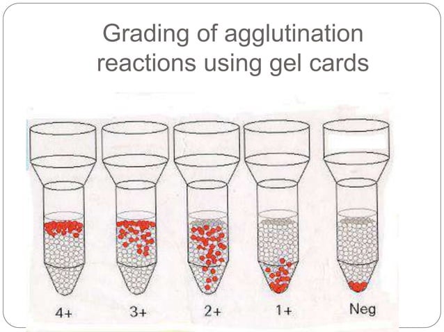 Crossmatching | PPTX