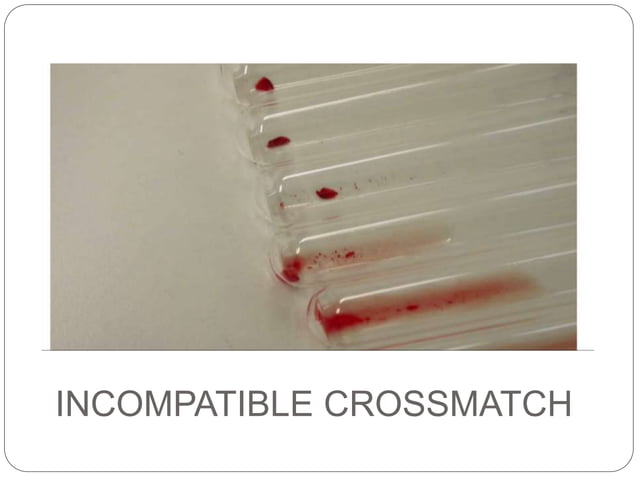 Crossmatching | PPTX