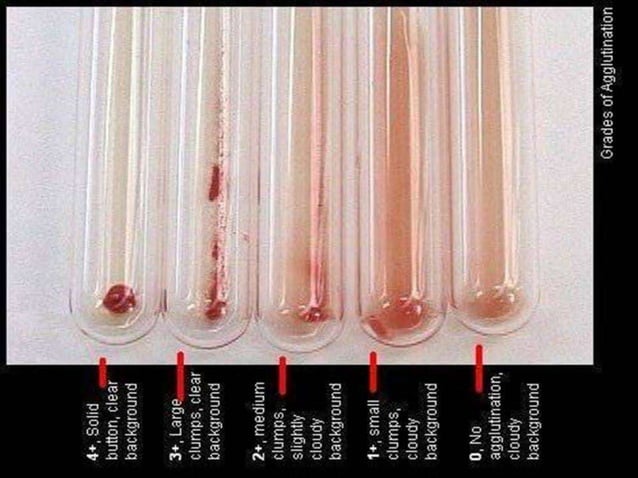 Crossmatching | PPTX