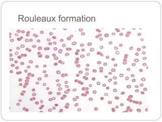 Crossmatching | PPTX