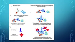 Crossmatch strategies in renal transplantation | PPTX