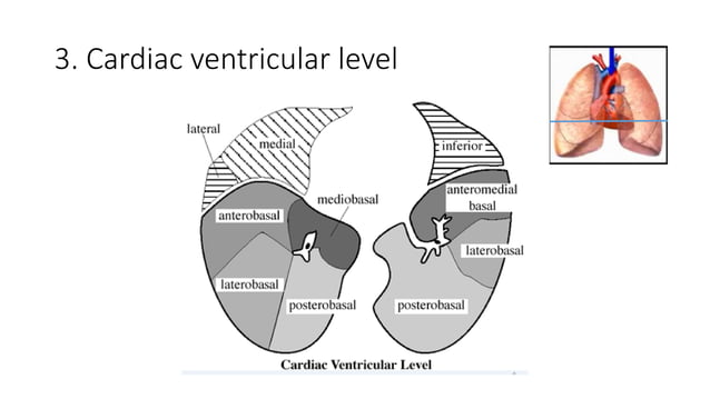 Cross sectional anatomy of chest by Dr. Milan Silwal, Resident, NAMS ...