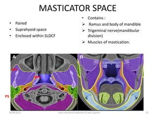 Cross sectional anatomy of neck spaces | PPTX