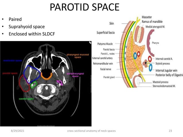 Cross sectional anatomy of neck spaces | PPTX