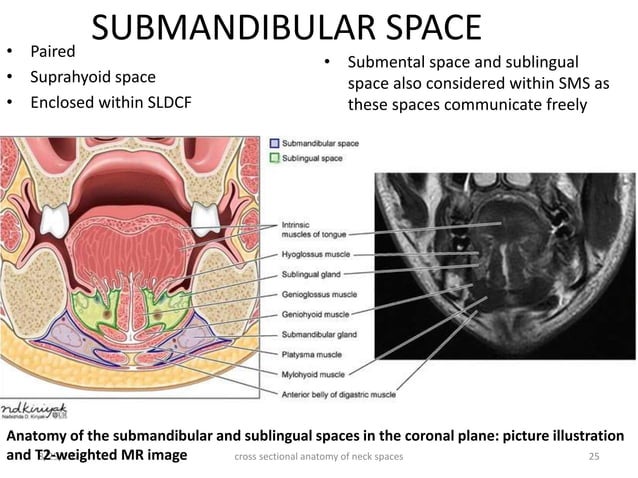 Cross sectional anatomy of neck spaces | PPTX