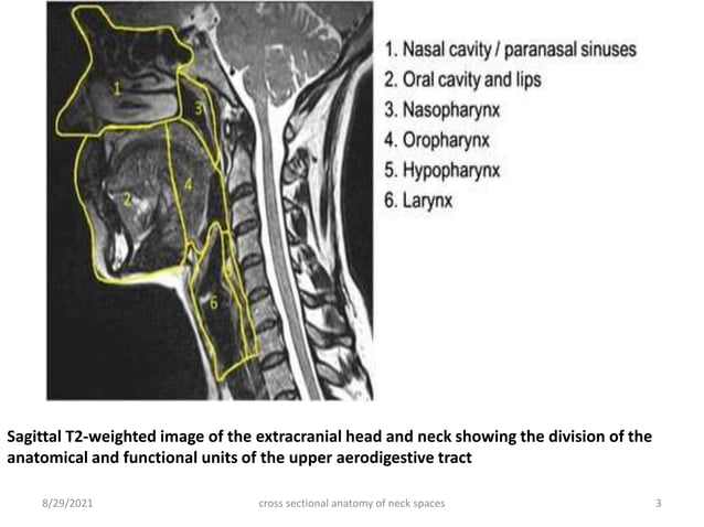 Cross sectional anatomy of neck spaces | PPTX