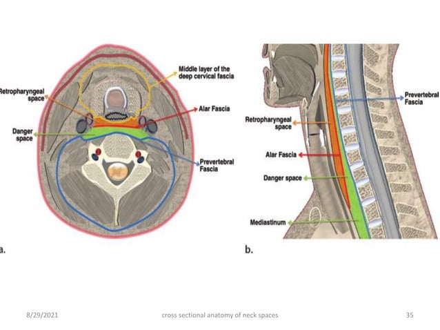 Cross sectional anatomy of neck spaces | PPTX