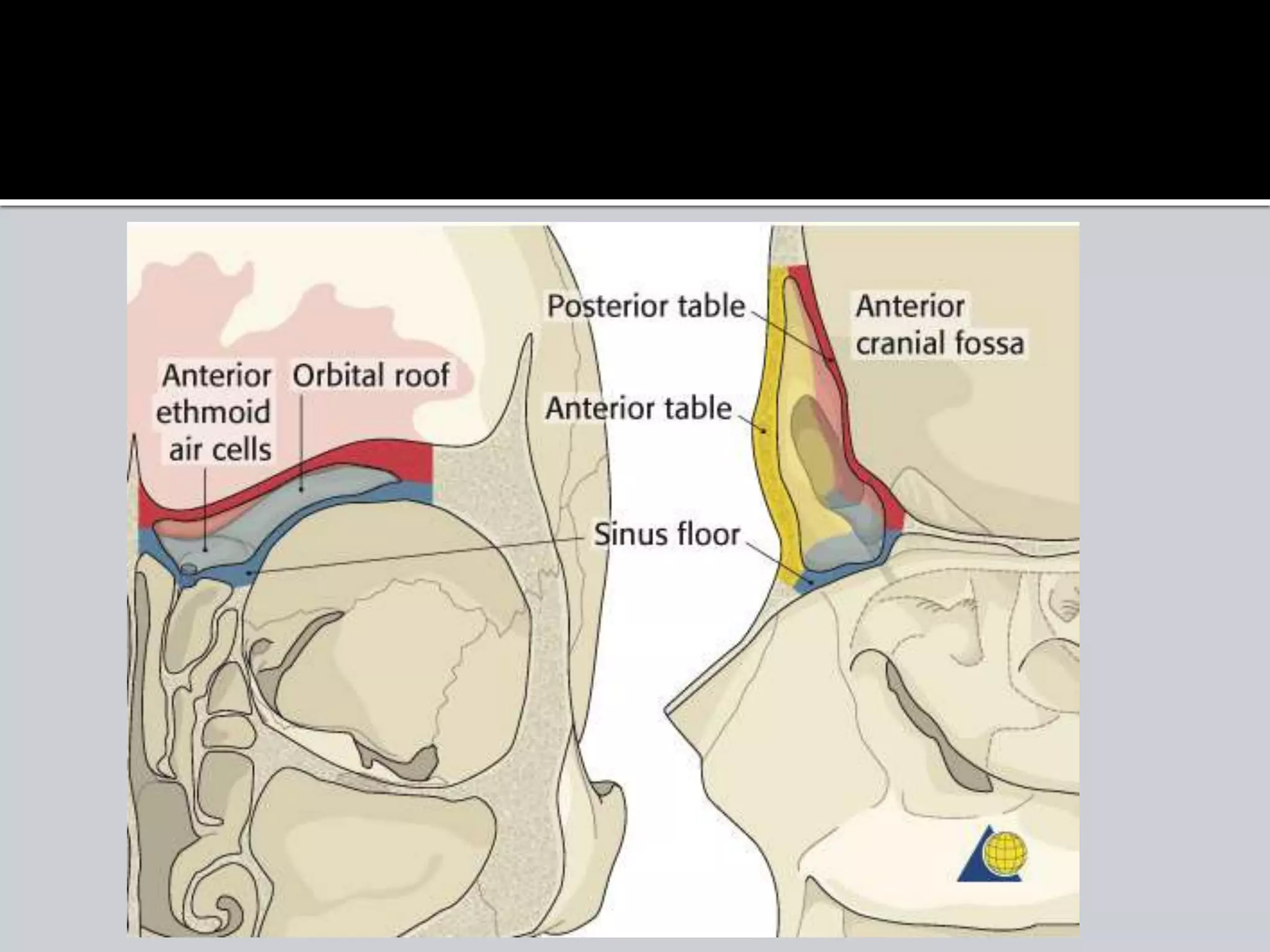 Cross Sectional Anatomy of Paranasal sinus | PPTX