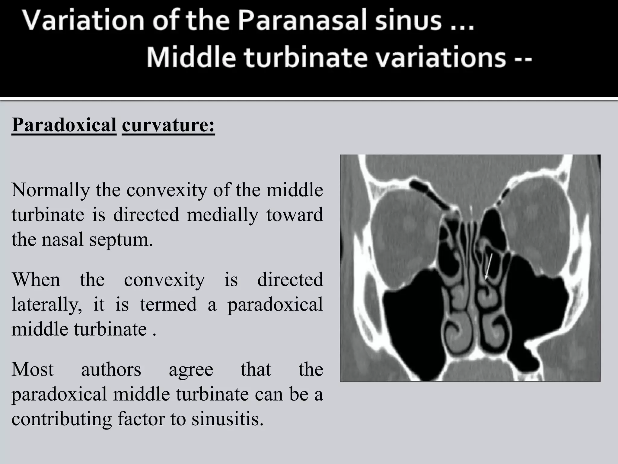 Cross Sectional Anatomy of Paranasal sinus | PPTX