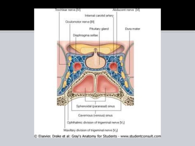 Cross Sectional Anatomy of Paranasal sinus | PPTX | Ear, Nose and ...